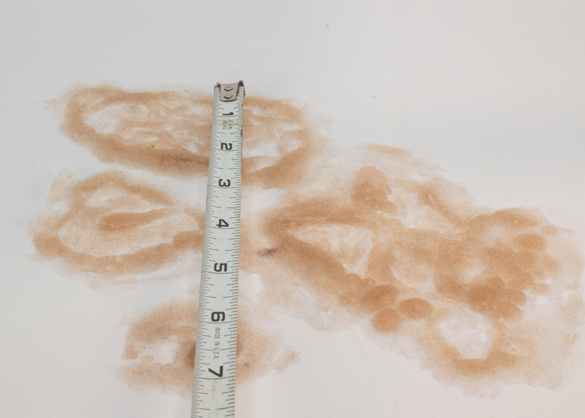 Silicone Prosthetic Thermal Burn Pack - WikedFX