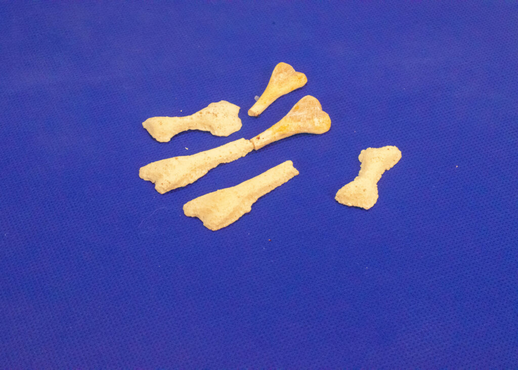 Silicone Prosthetic Top of Hand Injury Degloving - WikedFX