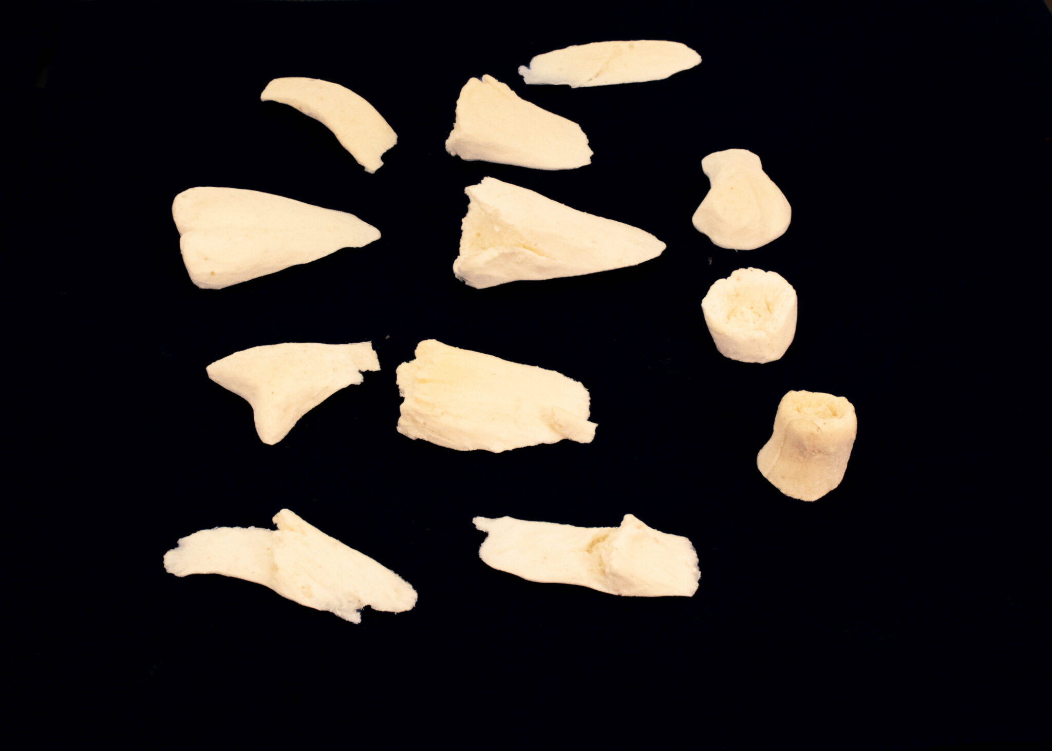 Assorted Open Fracture Prosthetic Bone Pack - WikedFX