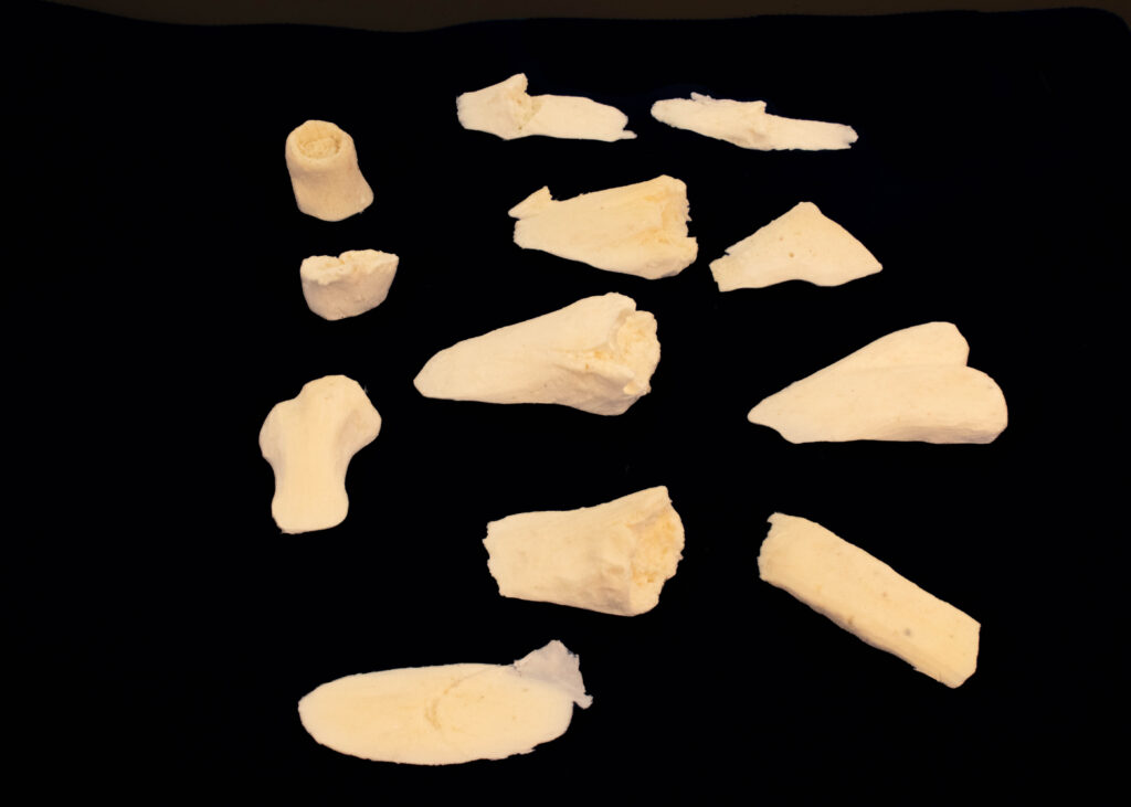 Assorted Open Fracture Prosthetic Bone Pack - WikedFX